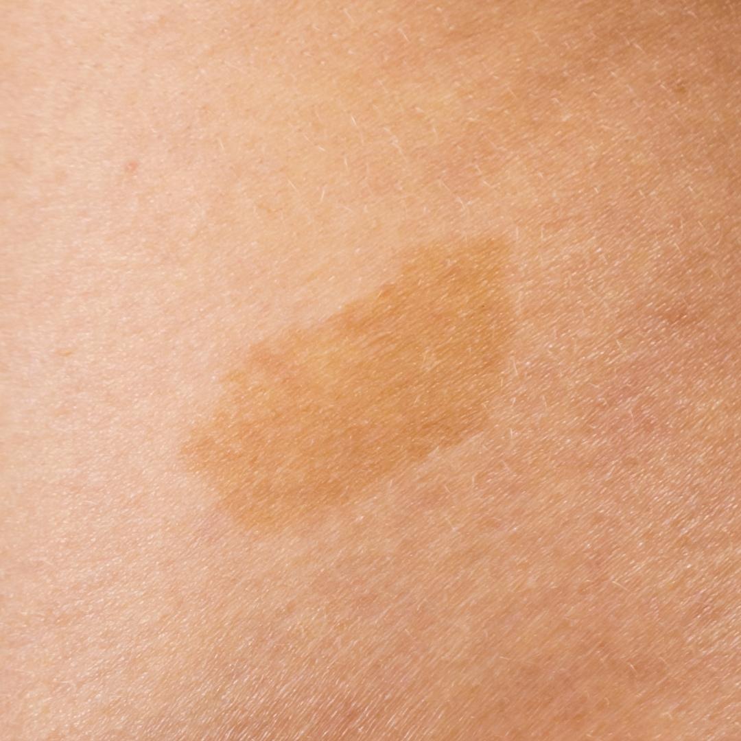 Where Do Skin Colors Come From? Melanin Science for Kids