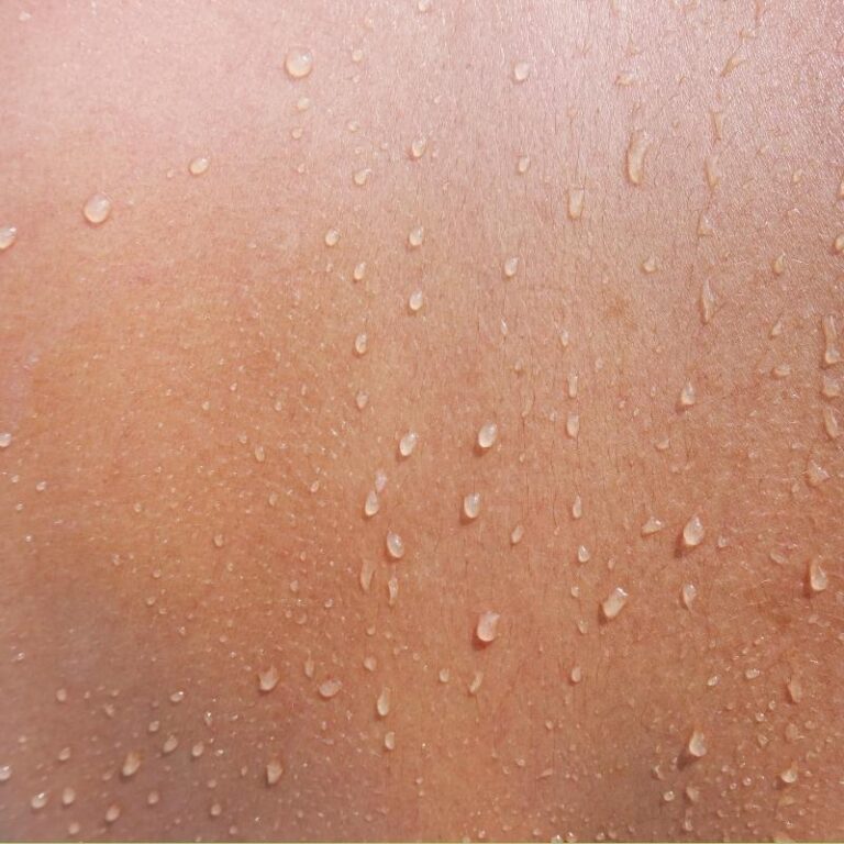 Skin Layers Anatomy Diagram for Kids