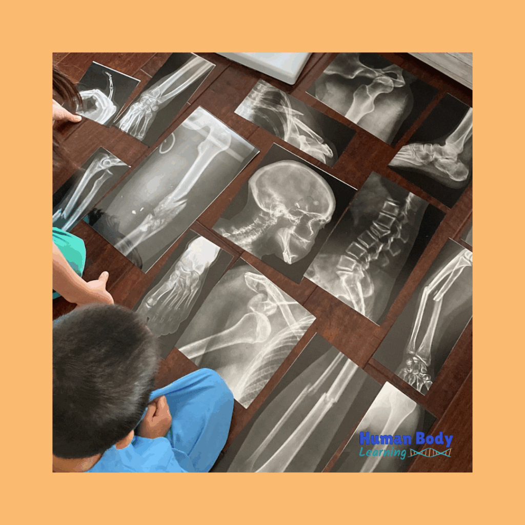 Why Do Bones Break Science Experiment For Kids